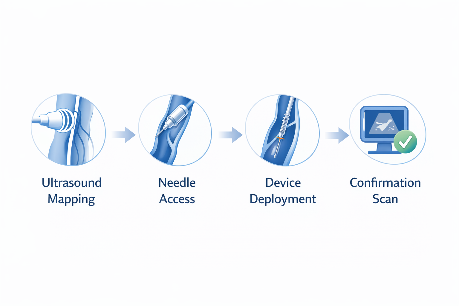 VCD Needle Design & Manufacturing: What Buyers Should Know - Media ...